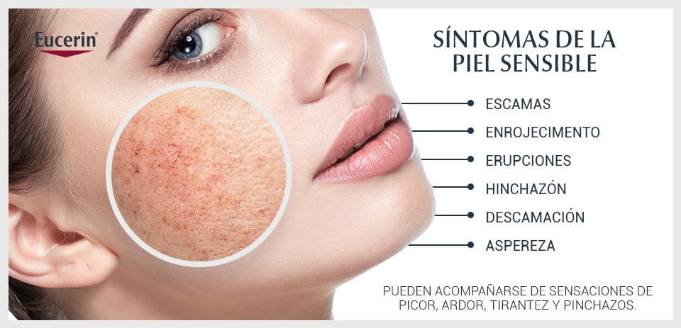 Piel sensible y seca: causas y tips para cuidarla | Eucerin®